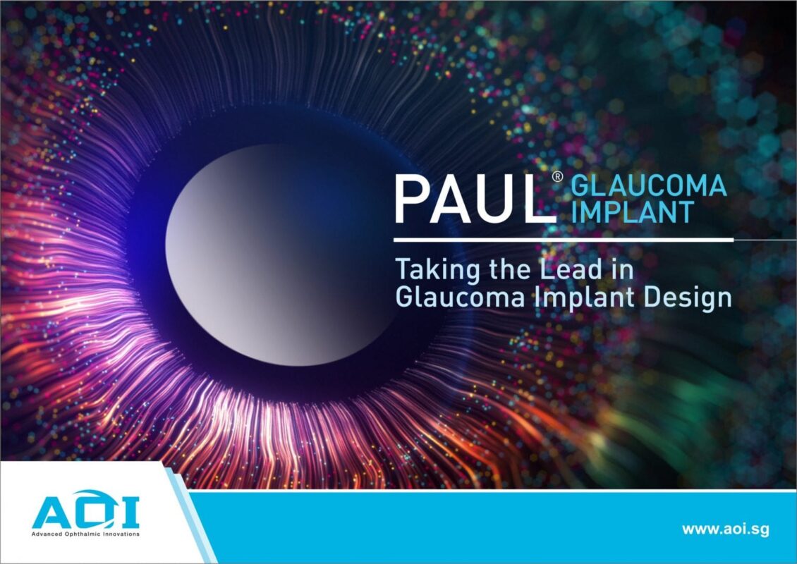 PAUL® Glaucoma Implant - https://iosgroup.net